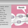 Parts of Braces | Gamache Orthodontics